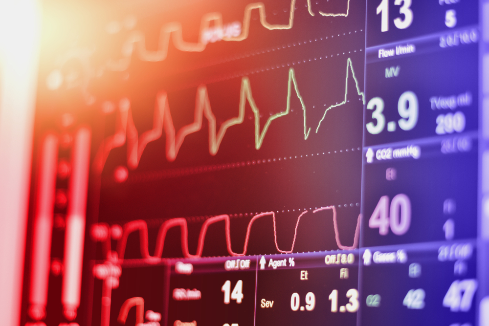 Stek advises IK Partners on the acquisition of Defibrion Group - Stek ...